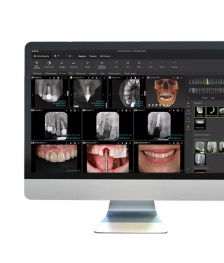 Getting started | DTX Studio suite